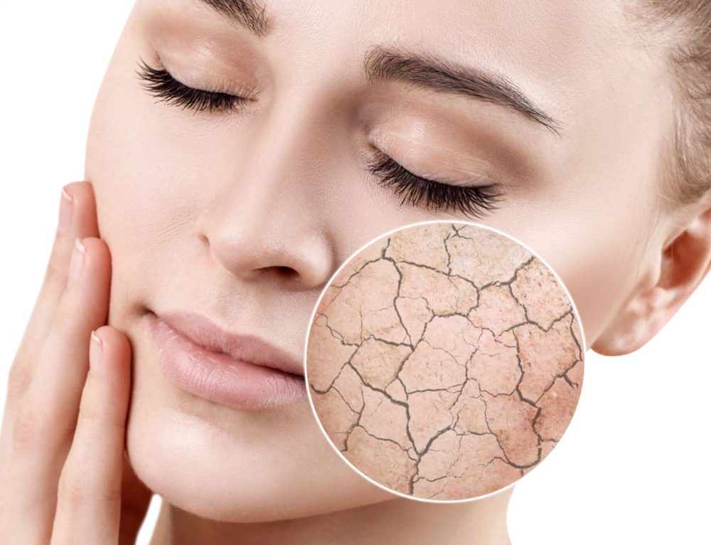 Pourquoi vos problèmes de peau sont souvent dûs a un déficit ...